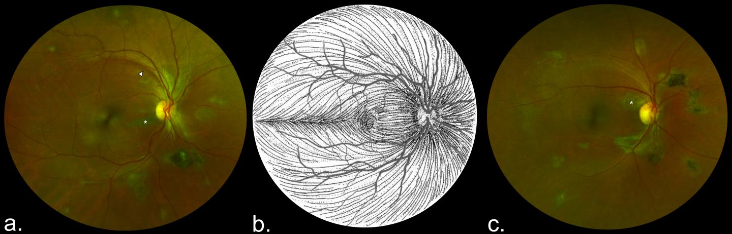 Composite Scanning Laser Ophth [IMAGE] | EurekAlert! Science News Releases