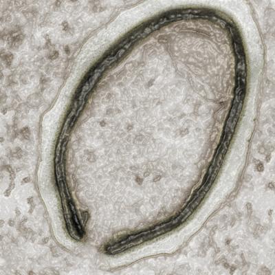 Supersized Viruses Break Recor [IMAGE] | EurekAlert! Science News Releases