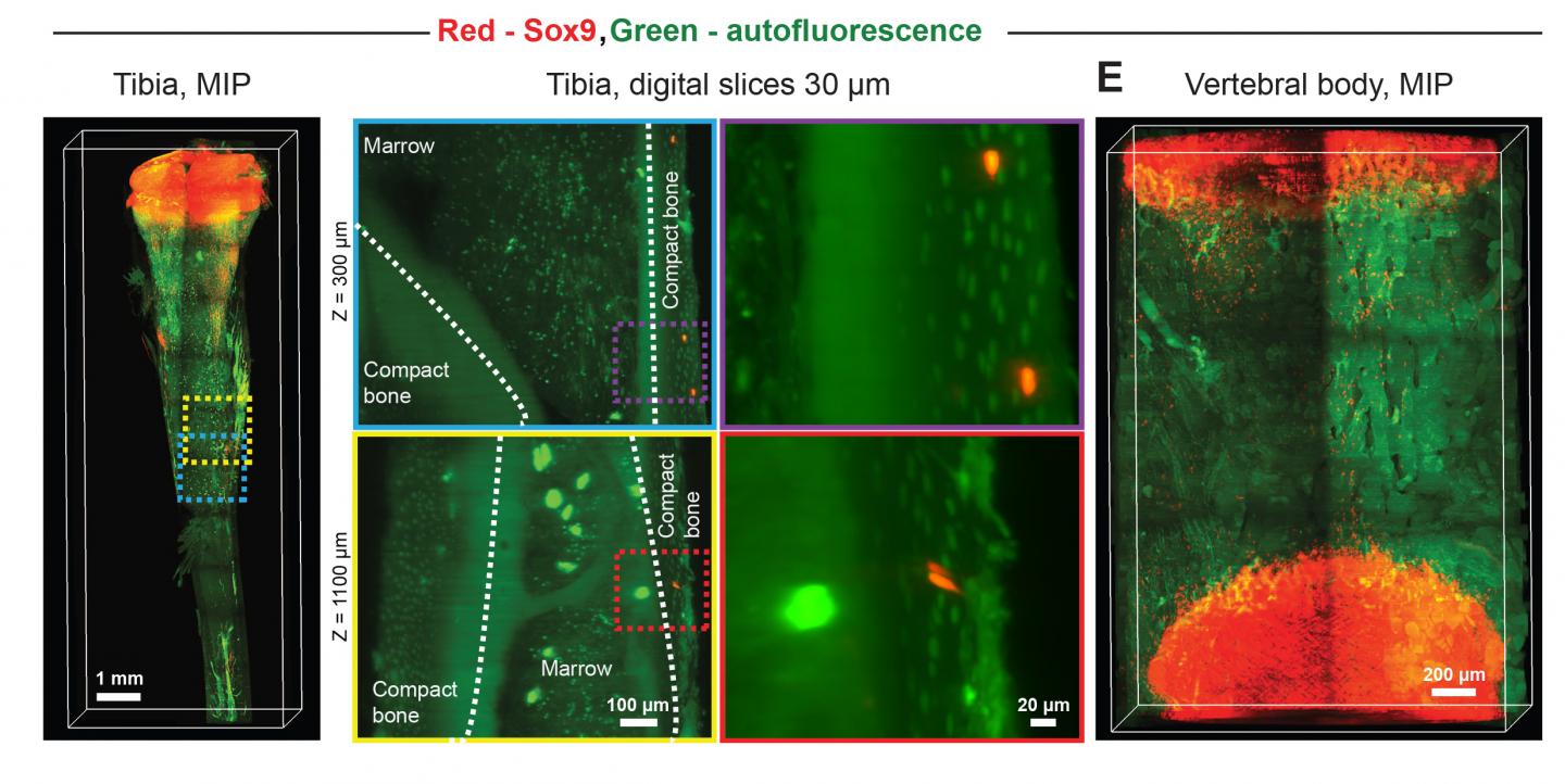 In the Clear: New Imaging Technique Makes Bon | EurekAlert!