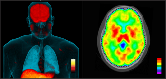 Study shows FDA-approved TB regimen may not w | EurekAlert!