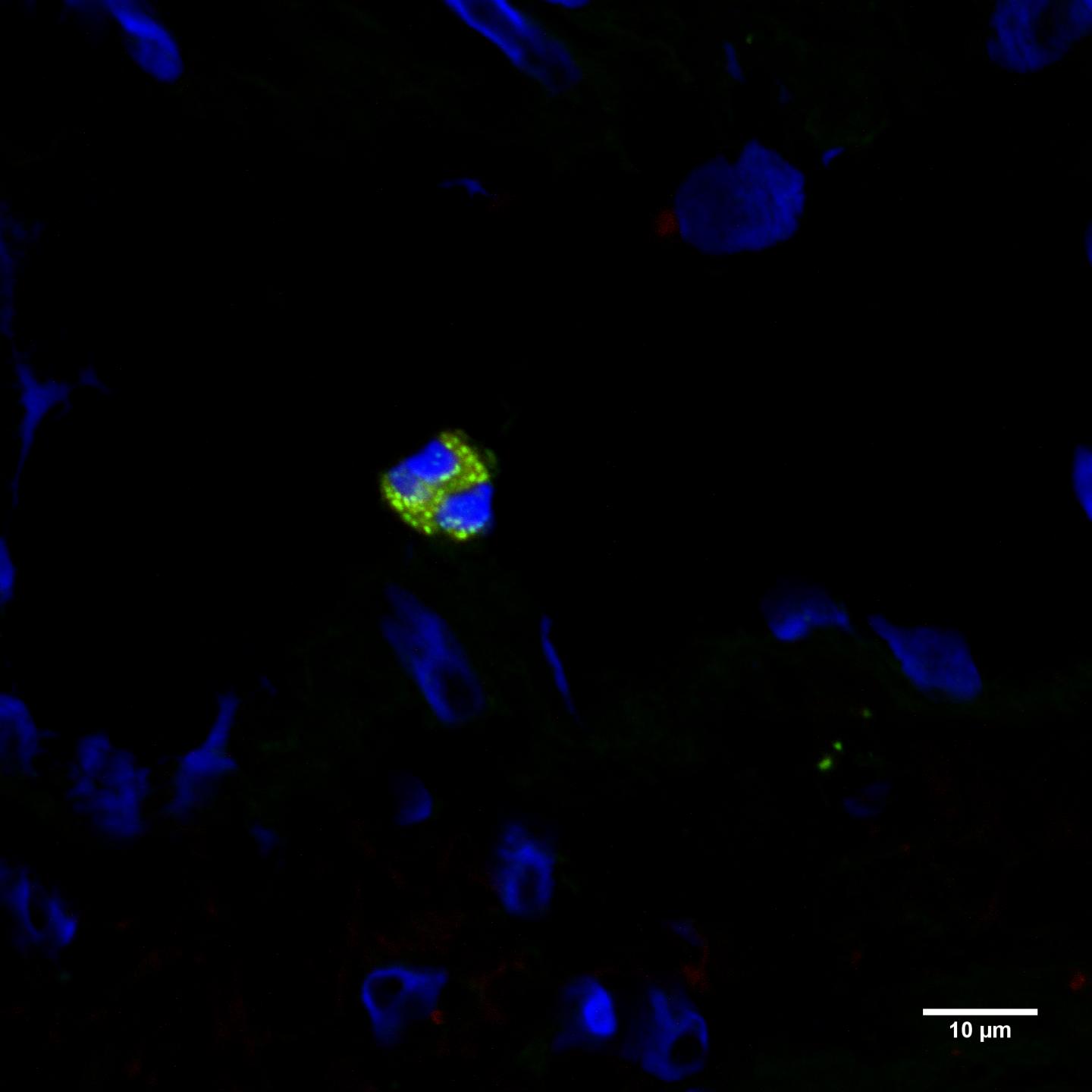 P2X4 Receptors (green) Inside [IMAGE] | EurekAlert! Science News Releases