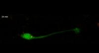Fantastic journey: How newborn neurons find t | EurekAlert!