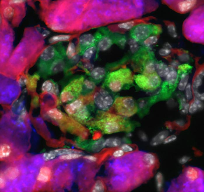 Acinar-derived insulin-produci [IMAGE] | EurekAlert! Science News Releases