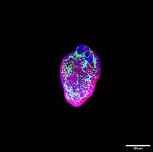 Heart organoids simulate pregestational diabe | EurekAlert!