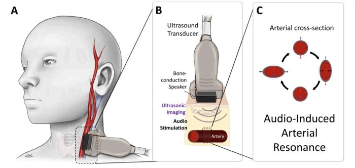 BP monitoring graphic [IMAGE] | EurekAlert! Science News Releases