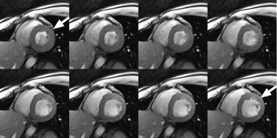 Real-time MRI [IMAGE] | EurekAlert! Science News Releases