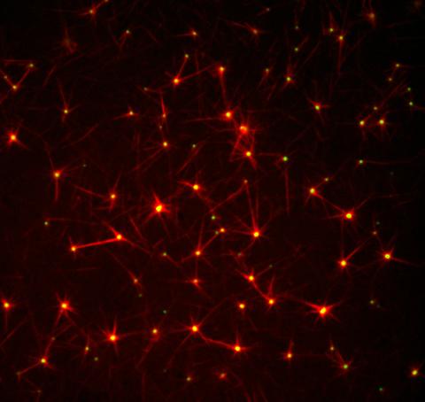 PLK4 Induced Aster Formation [IMAGE] | EurekAlert! Science News Releases