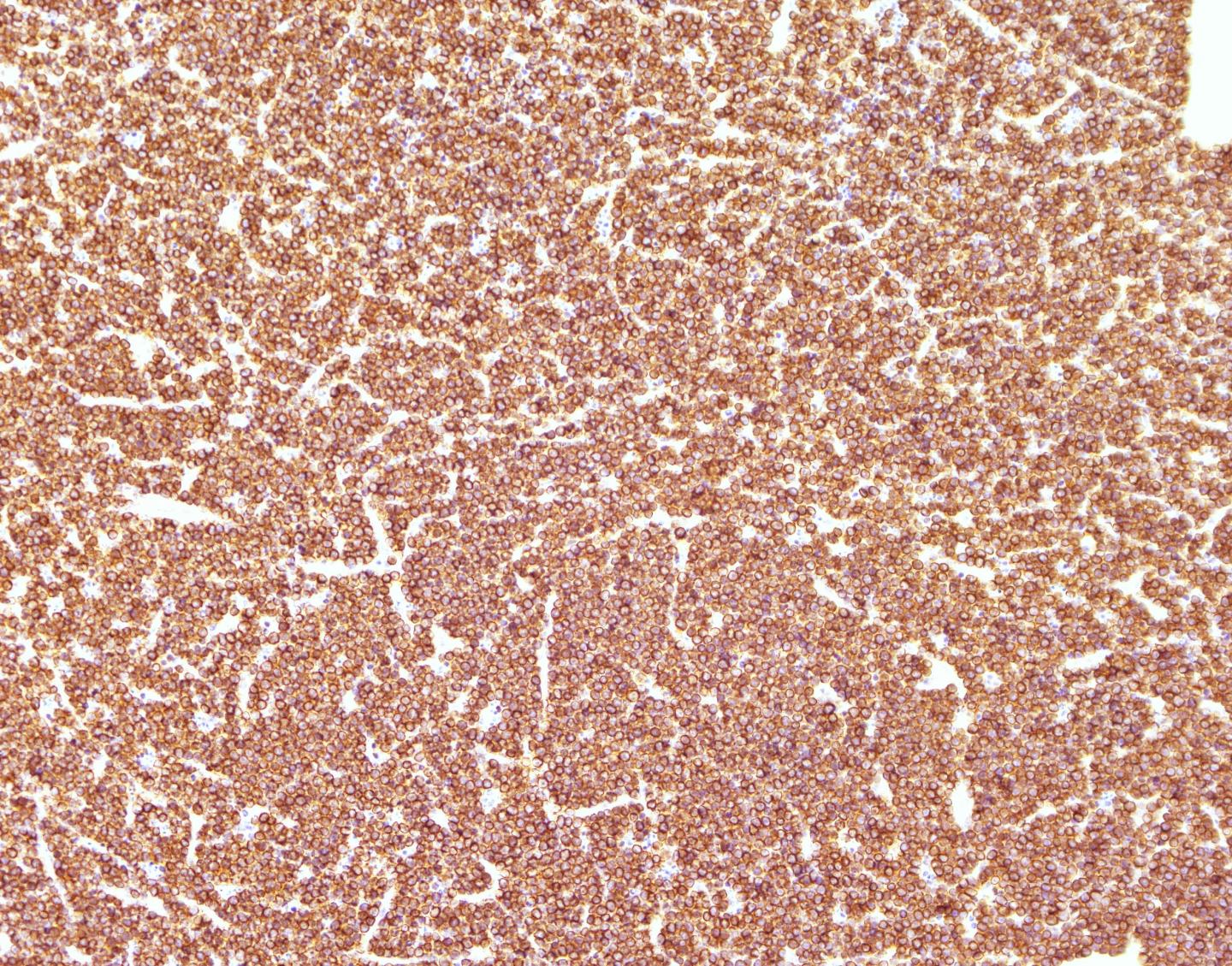 T-ALL mouse Model Sample [IMAGE] | EurekAlert! Science News Releases