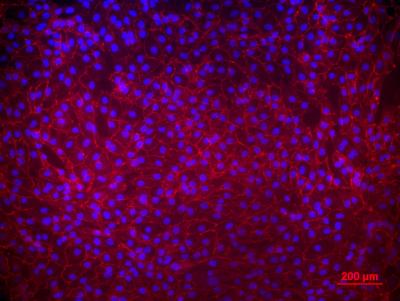 Renal Epithelium in Culture Di [IMAGE] | EurekAlert! Science News Releases