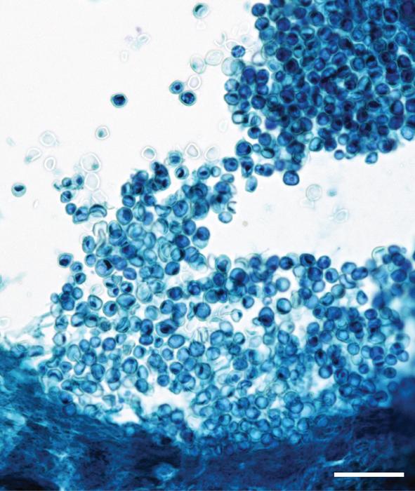 Giemsa staining provided evide [IMAGE] | EurekAlert! Science News Releases