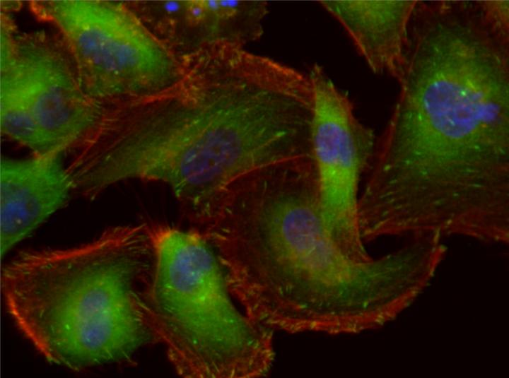 Metastatic Cancer Cells [IMAGE] | EurekAlert! Science News Releases