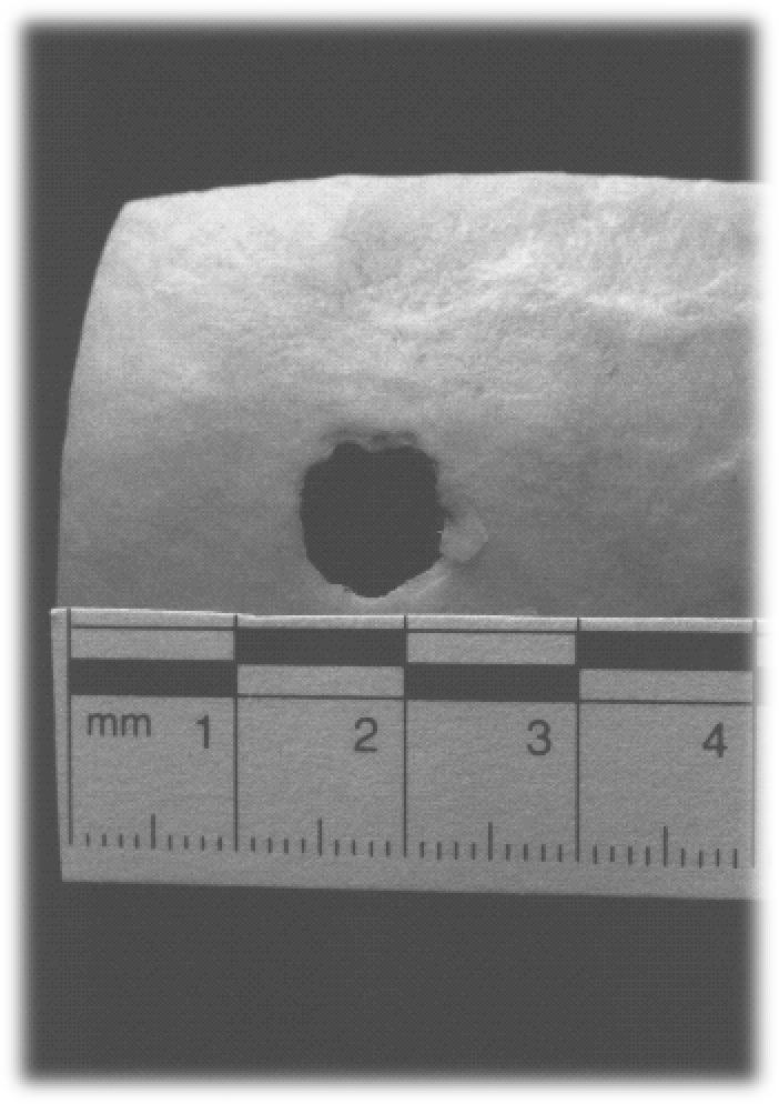 Forensic research finds bone density affects | EurekAlert!