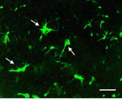 Iba1-Positive Microglia [IMAGE] | EurekAlert! Science News Releases