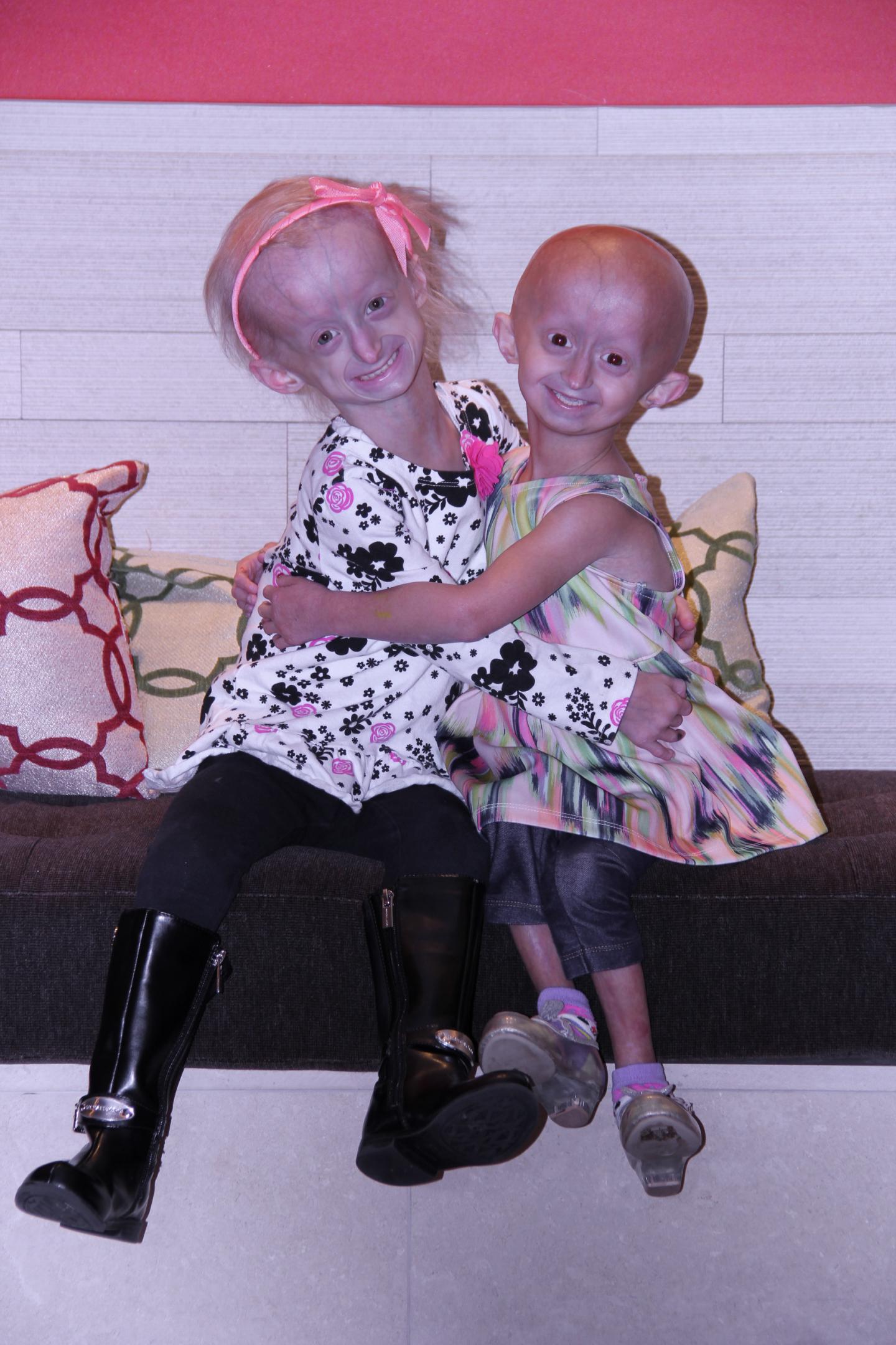 Truskey Progeria [IMAGE] | EurekAlert! Science News Releases