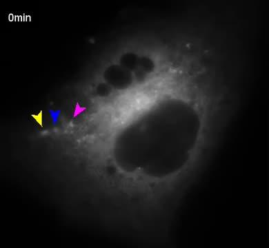 Revealed: How polyomavirus tricks our cells i | EurekAlert!