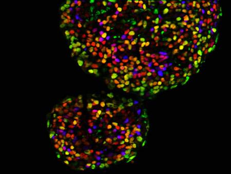 Pancreatic Stem Cells [IMAGE] | EurekAlert! Science News Releases