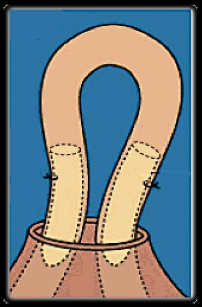 Intra Vas Device [IMAGE] | EurekAlert! Science News Releases