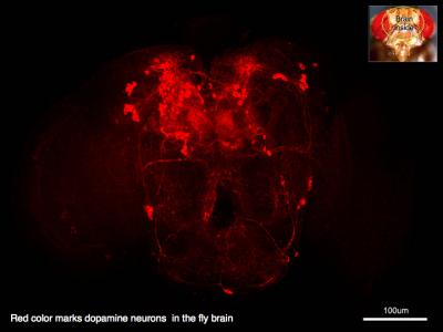 Dissected Fly Brain [IMAGE] | EurekAlert! Science News Releases