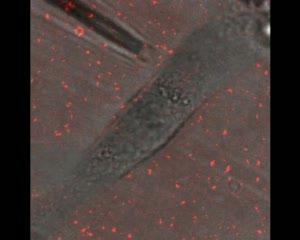 Protein Repairs Cell Damage in Muscle Dystrop | EurekAlert!