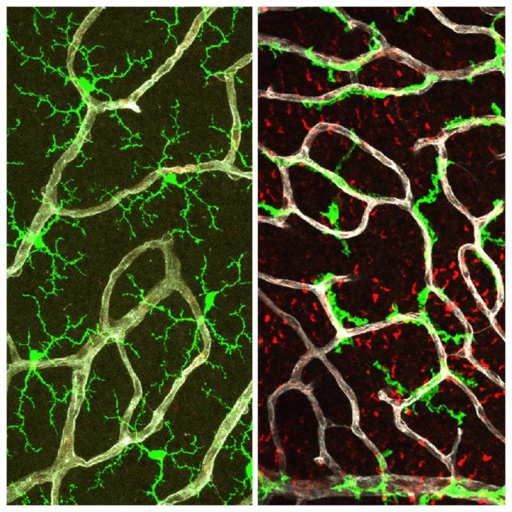 Retina With and Without TGF-Be [IMAGE] | EurekAlert! Science News Releases