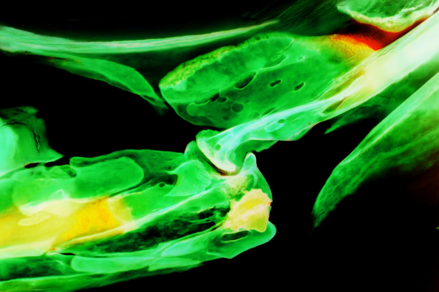 Zebrafish Jaw [IMAGE] | EurekAlert! Science News Releases