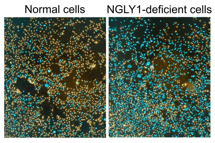 Normal Cells Compared to NGLY1 [IMAGE] | EurekAlert! Science News Releases