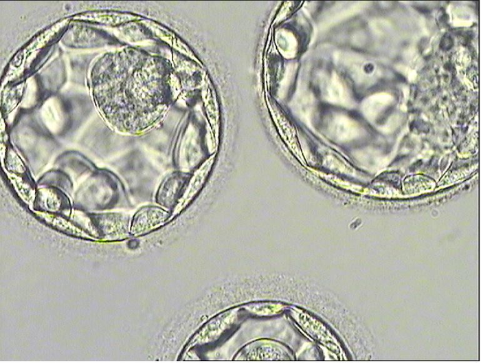 IVF Embryos. [IMAGE] | EurekAlert! Science News Releases