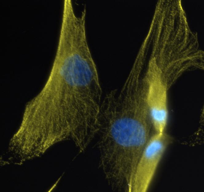 Human Fibroblasts Undergoing C [IMAGE] | EurekAlert! Science News Releases