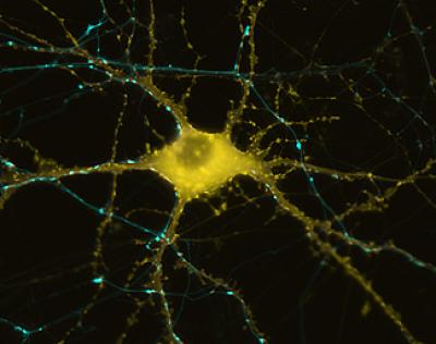 Human Neuron [IMAGE] | EurekAlert! Science News Releases