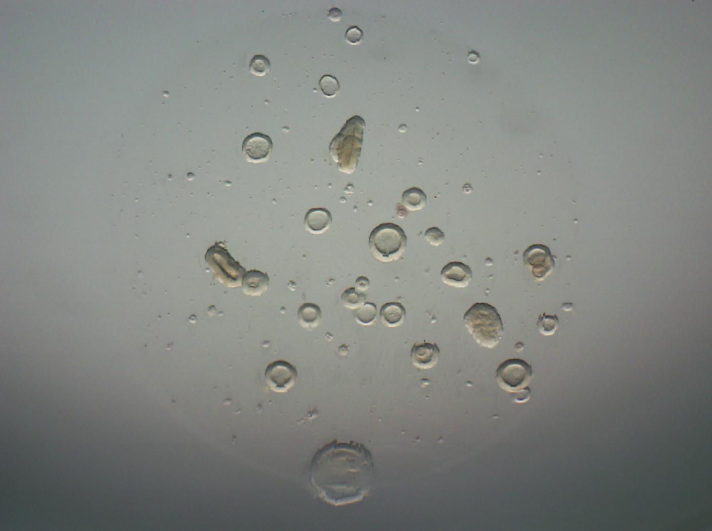 Organoids (1 of 2) [IMAGE] | EurekAlert! Science News Releases