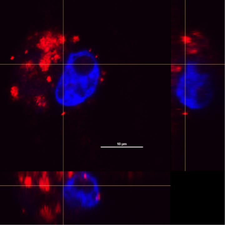 A Macrophage Cell [IMAGE] | EurekAlert! Science News Releases