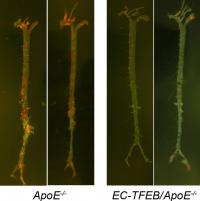 An Unexpected Protector Against Blood Vessel | EurekAlert!