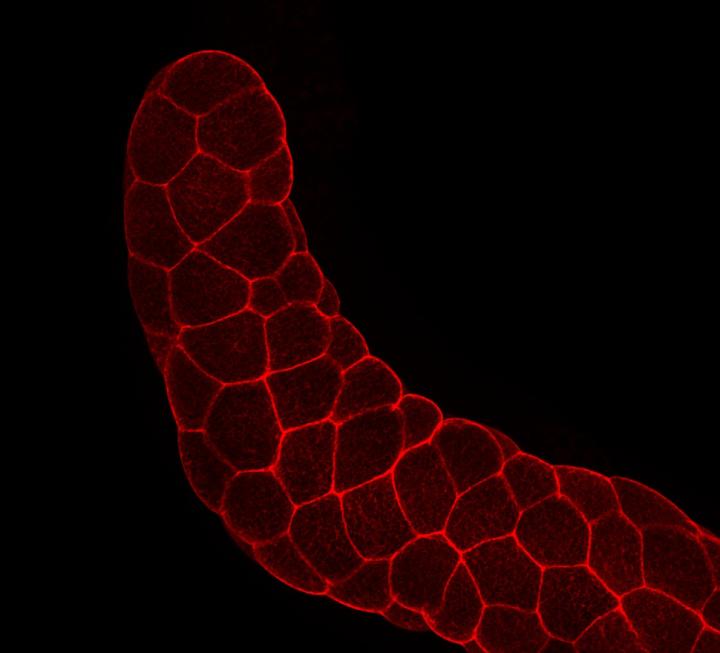 Fluorescence Microscopy [IMAGE] | EurekAlert! Science News Releases