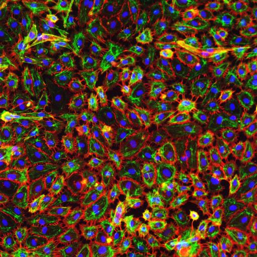 Blood Outgrowth Endothelial Ce [IMAGE] | EurekAlert! Science News Releases