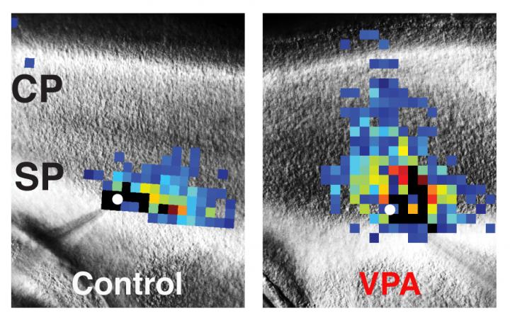 Control vs. VPA Treatment [IMAGE] | EurekAlert! Science News Releases