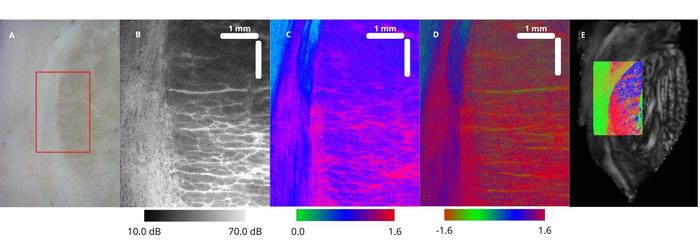 PS-OCT imaging [IMAGE] | EurekAlert! Science News Releases