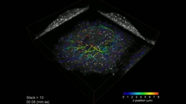 New Microscope Peers at Subcellular Gears in | EurekAlert!