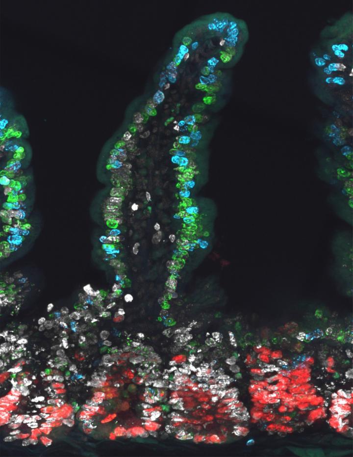 Intestine [IMAGE] | EurekAlert! Science News Releases