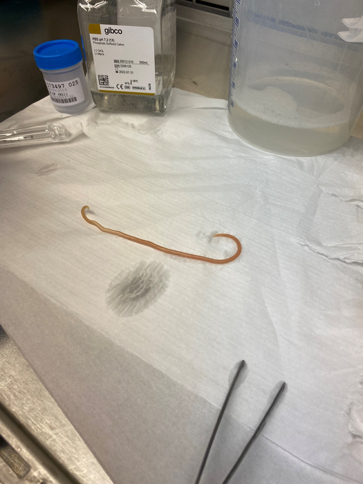 Roundworms 3 [IMAGE] | EurekAlert! Science News Releases