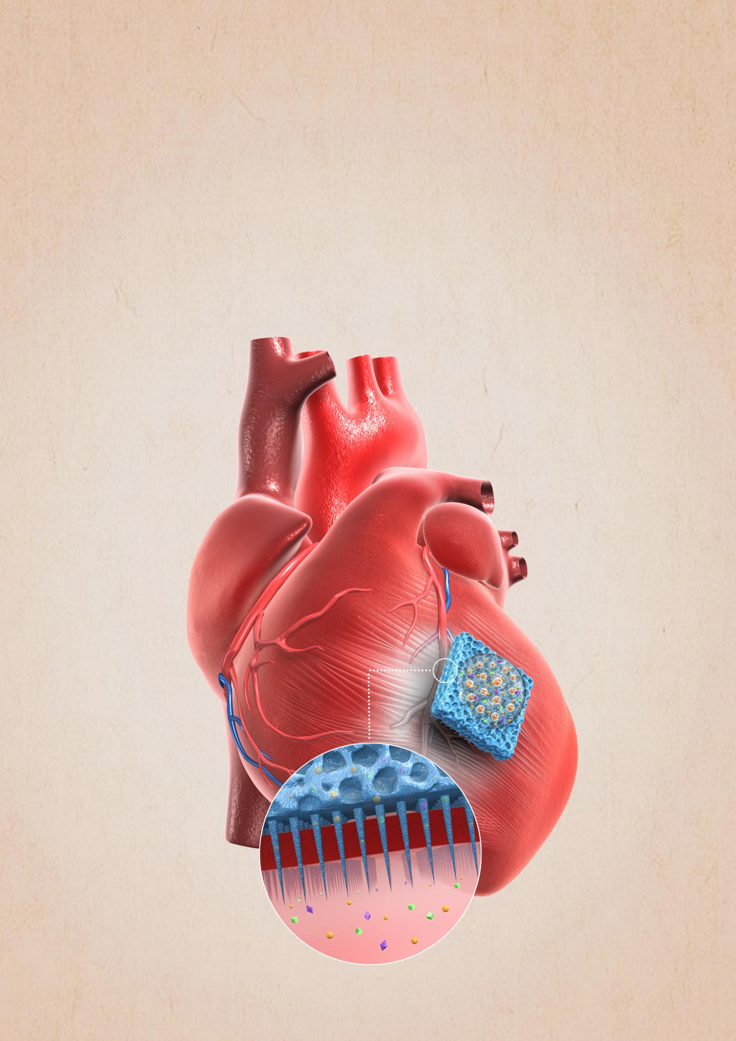 Cardiac cells integrated into microneedle pat | EurekAlert!