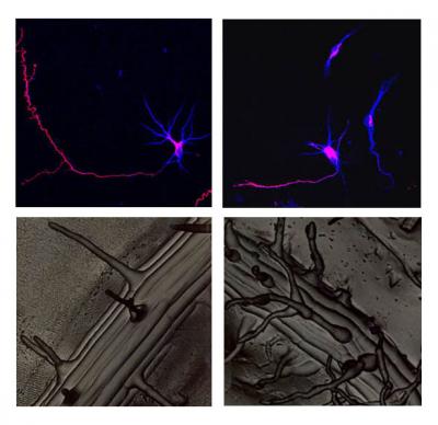 Neurons and Plant Roots Need A [IMAGE] | EurekAlert! Science News Releases