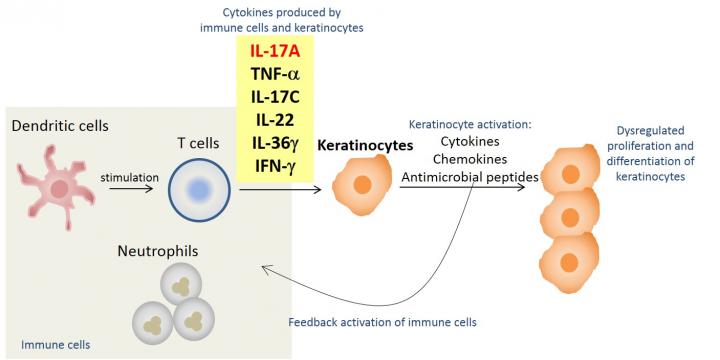 Model of Psoriasis Pathogenesi [IMAGE] | EurekAlert! Science News Releases