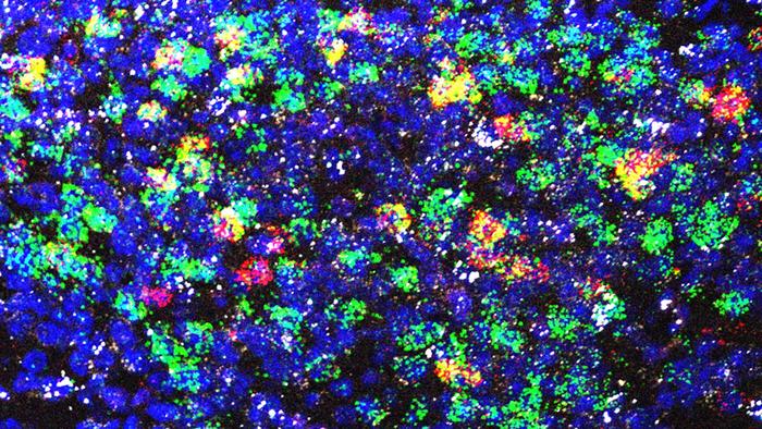 area postrema [IMAGE] | EurekAlert! Science News Releases