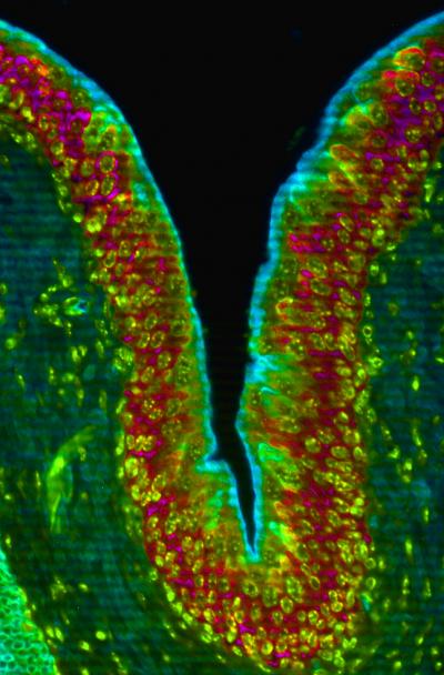 Bladder Lining [IMAGE] | EurekAlert! Science News Releases