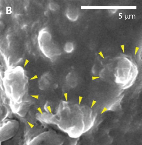 Microneedles Capture Inaccessible Immune Cell | EurekAlert!