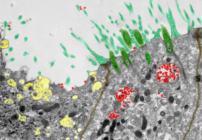 Nasal COVID-19 factories [IMAGE] | EurekAlert! Science News Releases