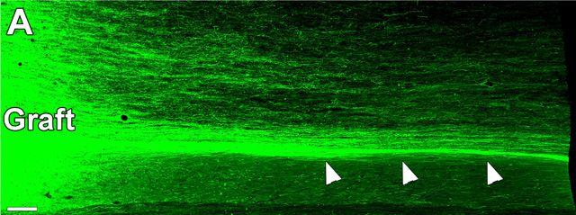 Researchers use human neural stem cell grafts | EurekAlert!