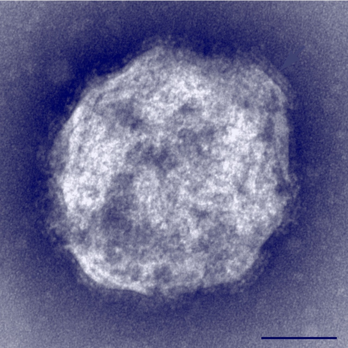 Discovery of new Hendra virus variant a lesso | EurekAlert!