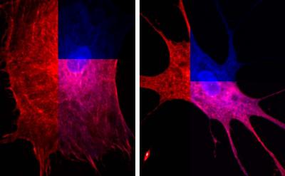 Stress-Shaped Proteins (1 of 3) | EurekAlert!
