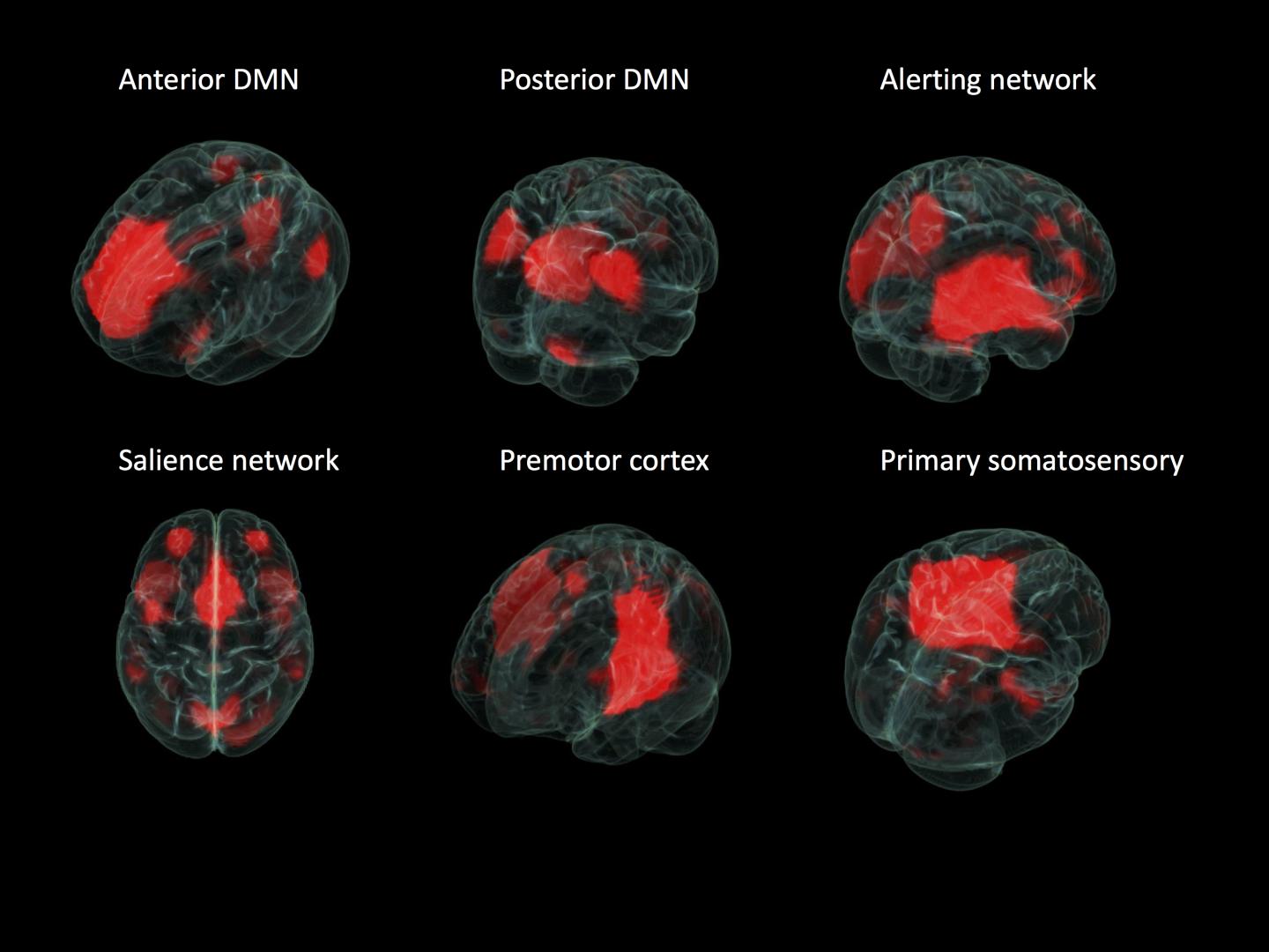 Brain Mapping [IMAGE] | EurekAlert! Science News Releases